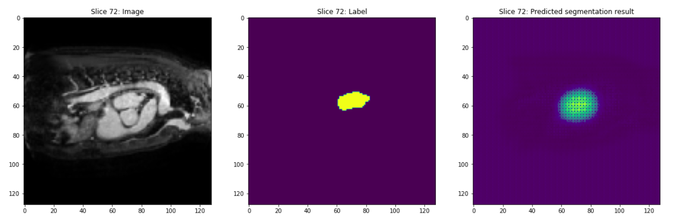 GitHub - PawelDrazkowski/Heart_Segmentation_with_UNet