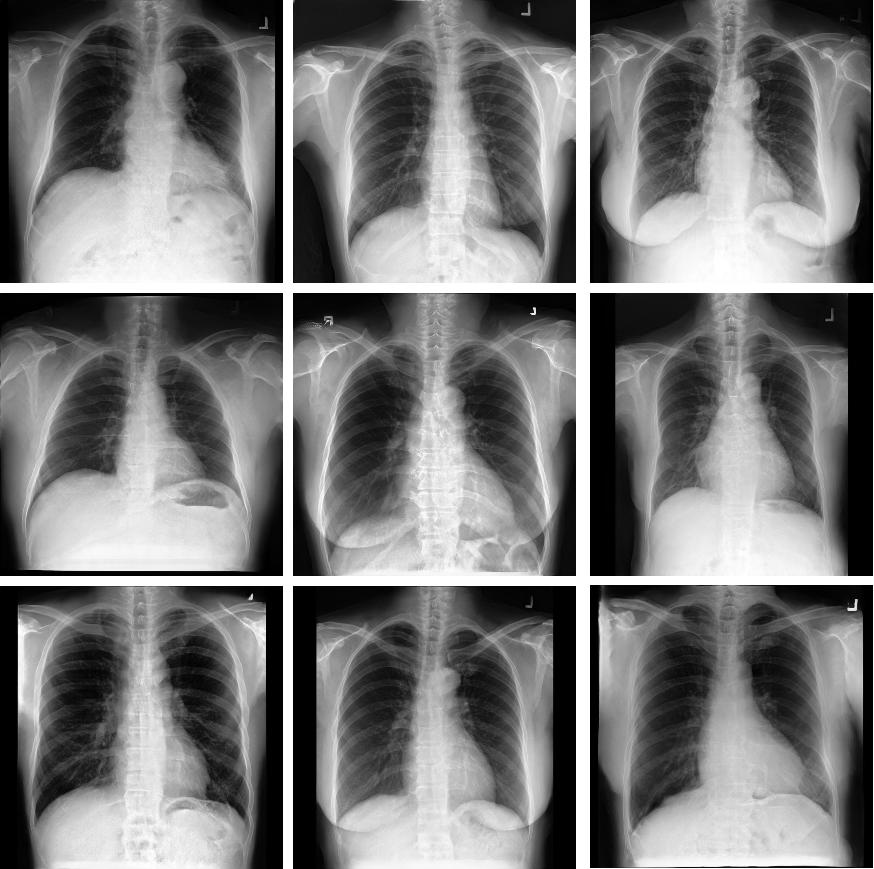 GitHub - worapanda/ACI_CTR