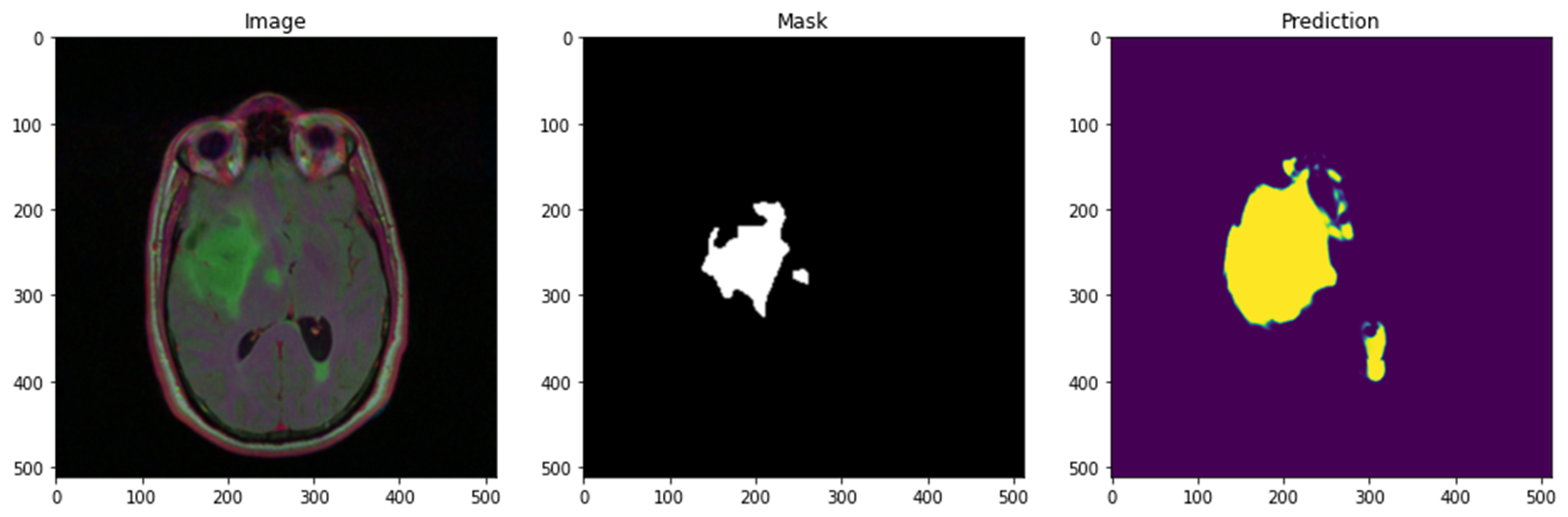 GitHub - dubidoo95/attention_and_transformer_in_U-Net