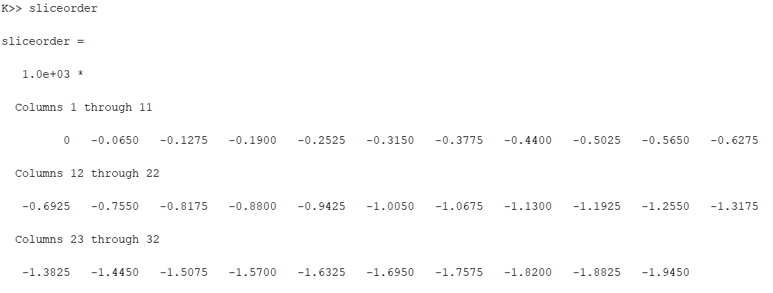 Elaboration on some modules · Issue #337 · automaticanalysis/automaticanalysis · GitHub