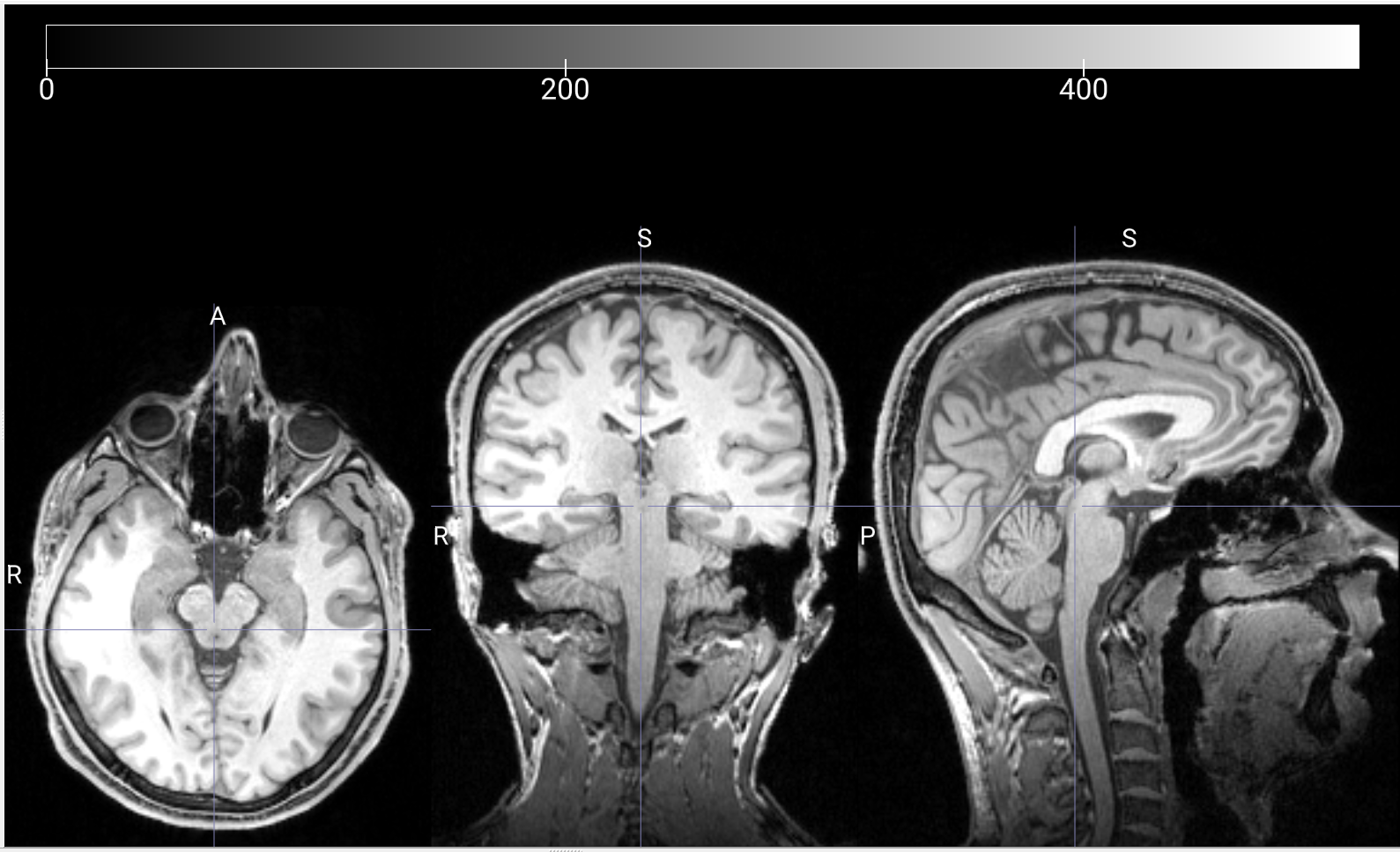 Utilizing aamod_compSignal · Issue #350 · automaticanalysis/automaticanalysis · GitHub