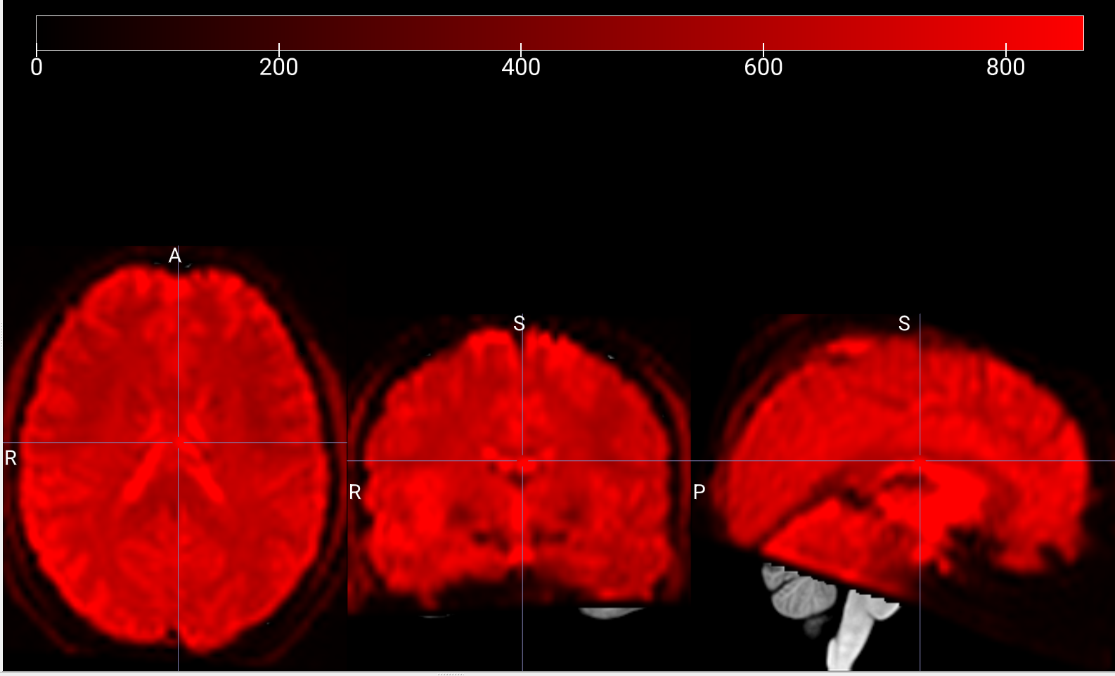 Utilizing aamod_compSignal · Issue #350 · automaticanalysis/automaticanalysis · GitHub