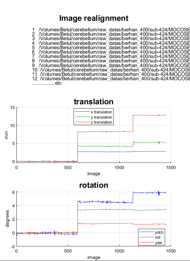 Realignment graph differences · Issue #376 · automaticanalysis/automaticanalysis · GitHub