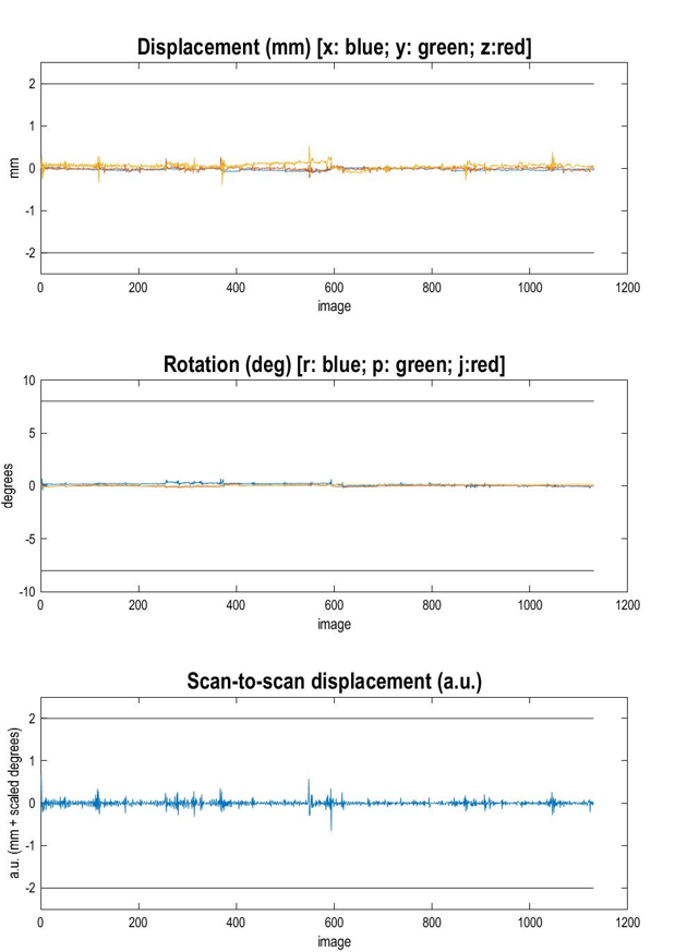 Realignment graph differences · Issue #376 · automaticanalysis/automaticanalysis · GitHub