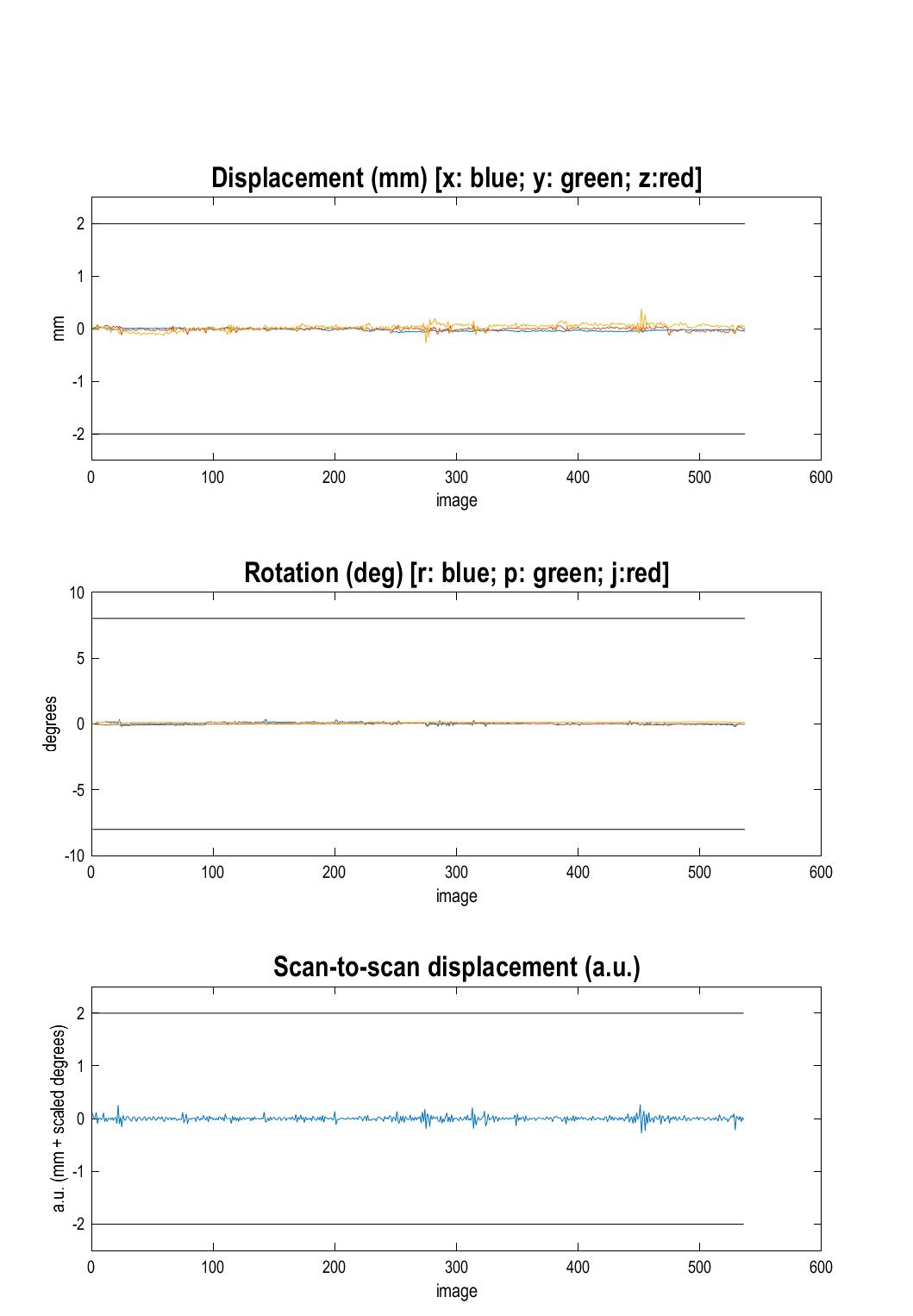 Realignment graph differences · Issue #376 · automaticanalysis/automaticanalysis · GitHub
