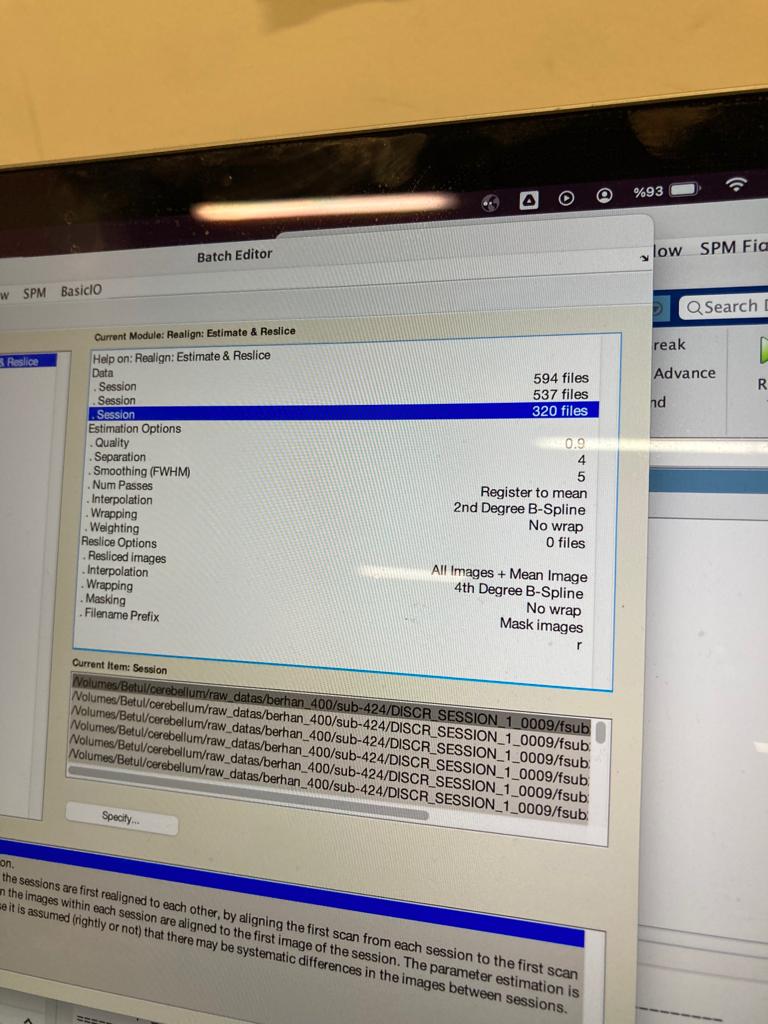 Realignment graph differences · Issue #376 · automaticanalysis/automaticanalysis · GitHub