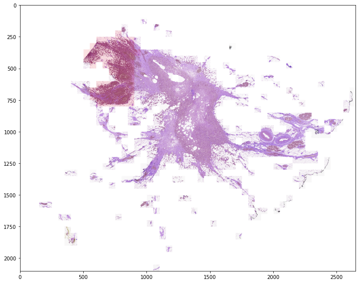 GitHub - tamdaominh0218/Breast-cancer-classification-using-Deep ...