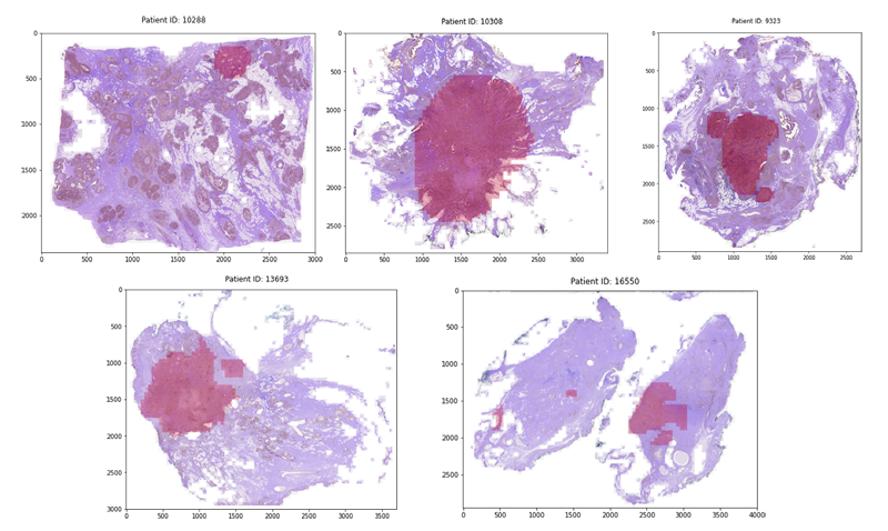 GitHub - tamdaominh0218/Breast-cancer-classification-using-Deep ...