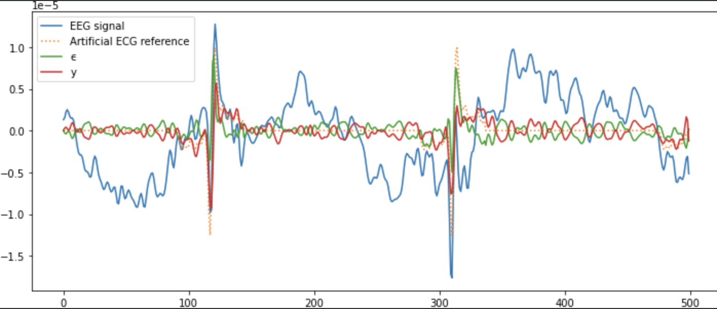 ECG adaptive filtering · GitHub