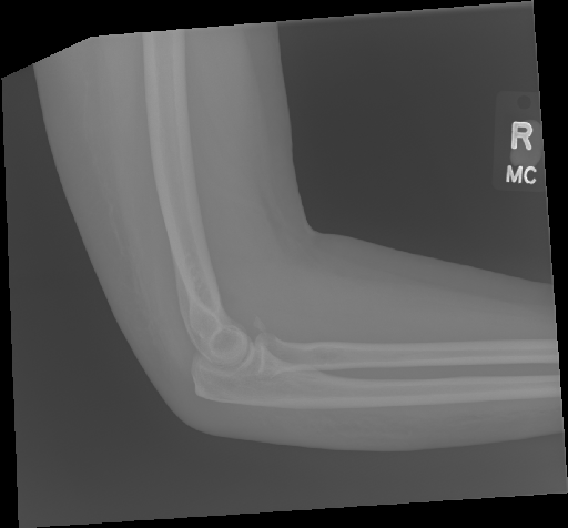 GitHub - nikhilkethu/Bone-Fracture-Recognition-using-Deep-Neural-Network