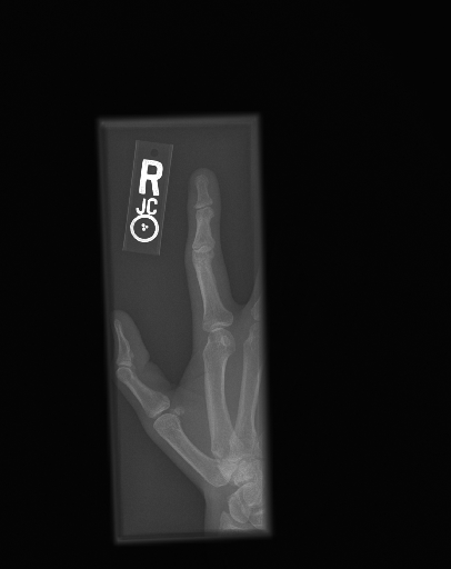 GitHub - nikhilkethu/Bone-Fracture-Recognition-using-Deep-Neural-Network