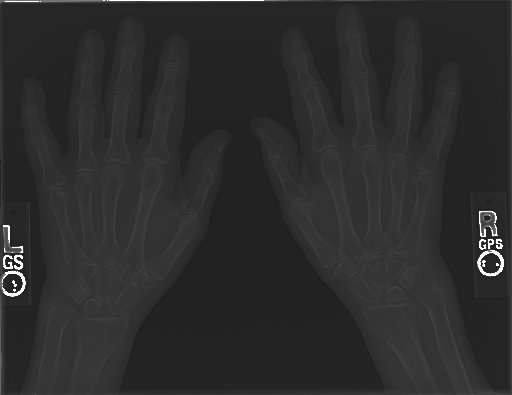 GitHub - nikhilkethu/Bone-Fracture-Recognition-using-Deep-Neural-Network