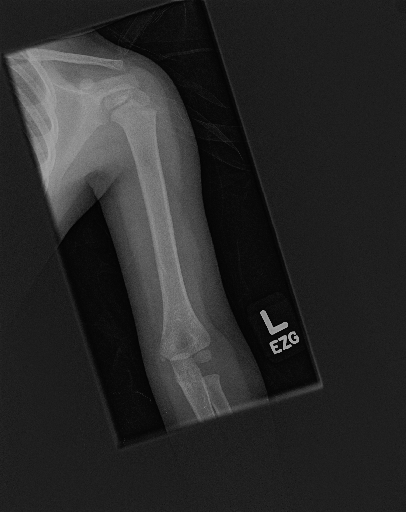 GitHub - nikhilkethu/Bone-Fracture-Recognition-using-Deep-Neural-Network