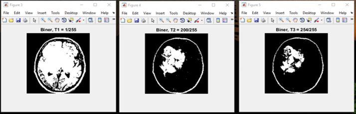 GitHub - electricianinsomniac/Preprocessing-images: Preprocessing images - Segmentation with ...