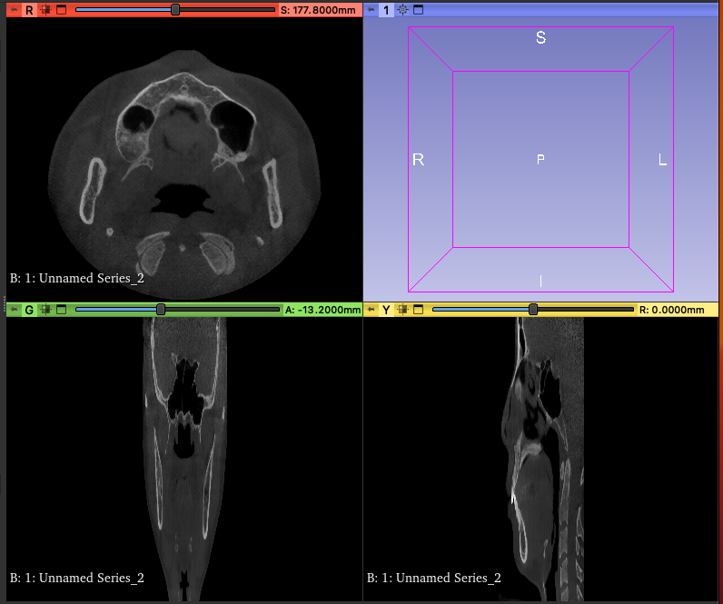 z spacing incorrectly read for multi-frame dicom · Issue #6773 · Slicer ...