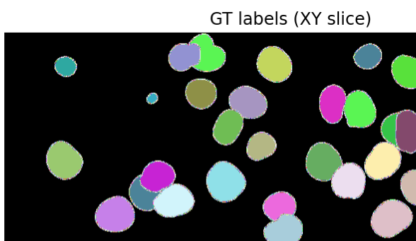 Kernel restart · Issue #60 · stardist/stardist · GitHub