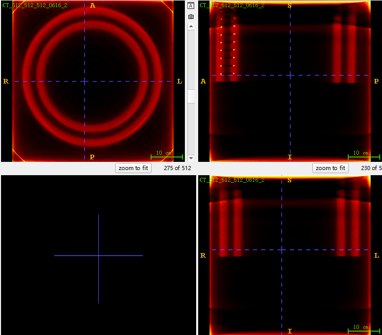 Self-designed CT reconstruction using OMEGA · Issue #42 · villekf/OMEGA · GitHub