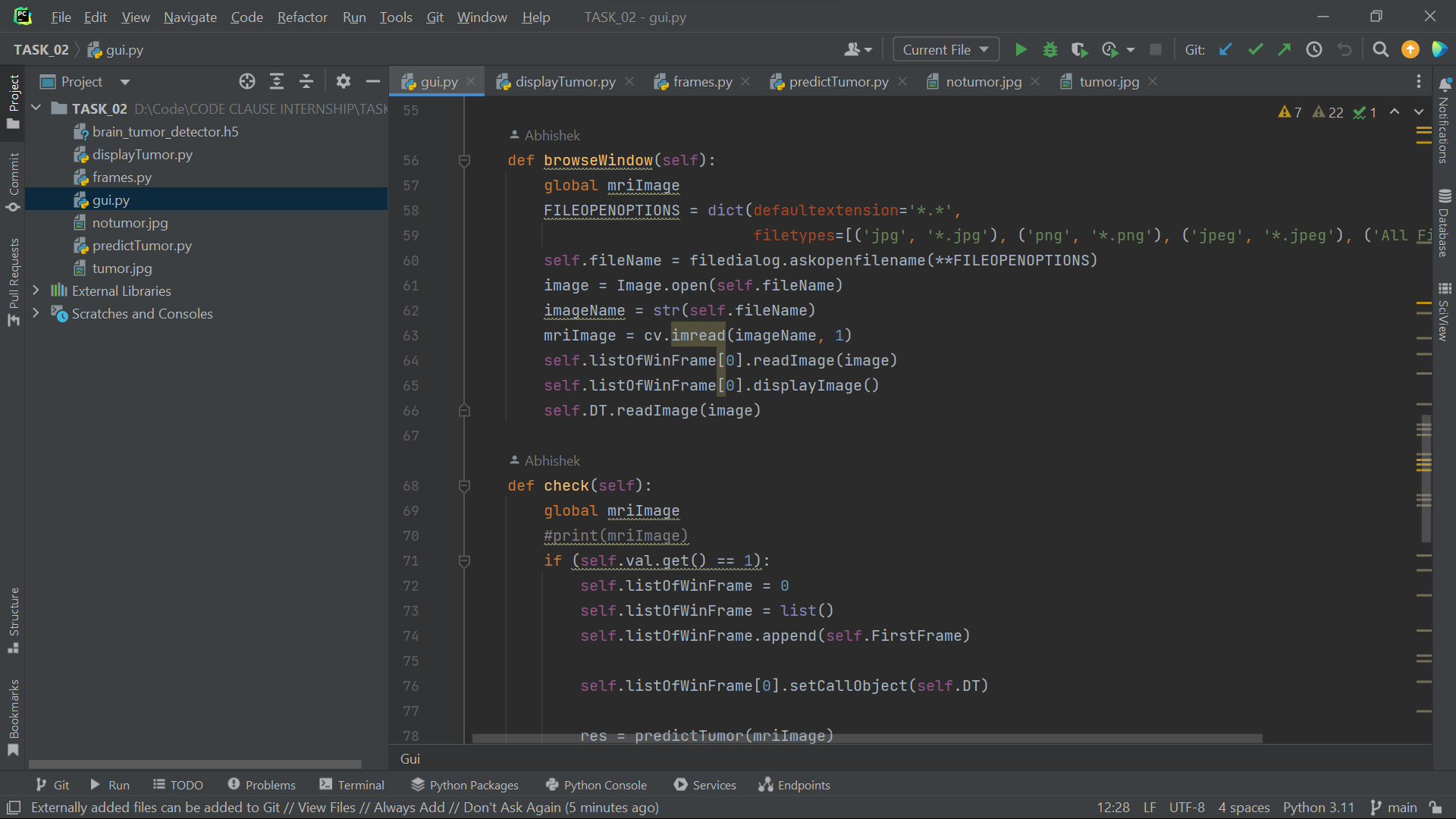 GitHub - Abhisdas/CodeClause_Brain_Tumor_Detection: 𝐁𝐫𝐚𝐢𝐧_𝐓𝐮𝐦𝐨𝐫_𝐃𝐞𝐭𝐞𝐜𝐭𝐢𝐨𝐧 𝐏𝐫𝐨𝐣𝐞𝐜𝐭.
