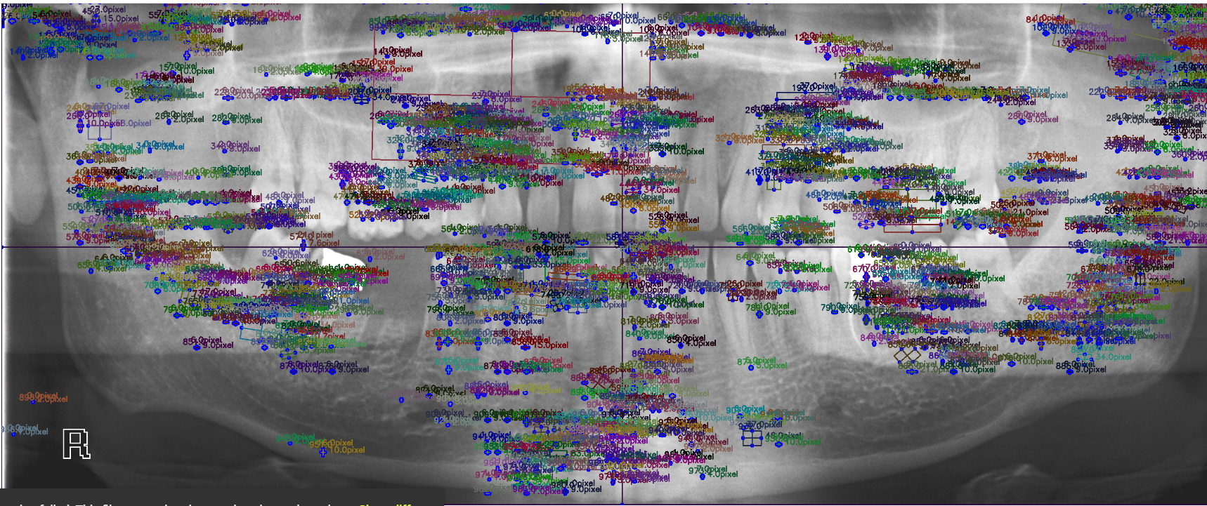 Plotting result example · Issue #6 · SerdarHelli/Segmentation-of-Teeth-in-Panoramic-X-ray-Image ...