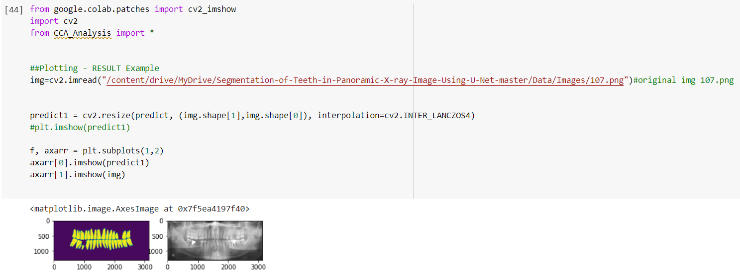 Plotting result example · Issue #6 · SerdarHelli/Segmentation-of-Teeth-in-Panoramic-X-ray-Image ...
