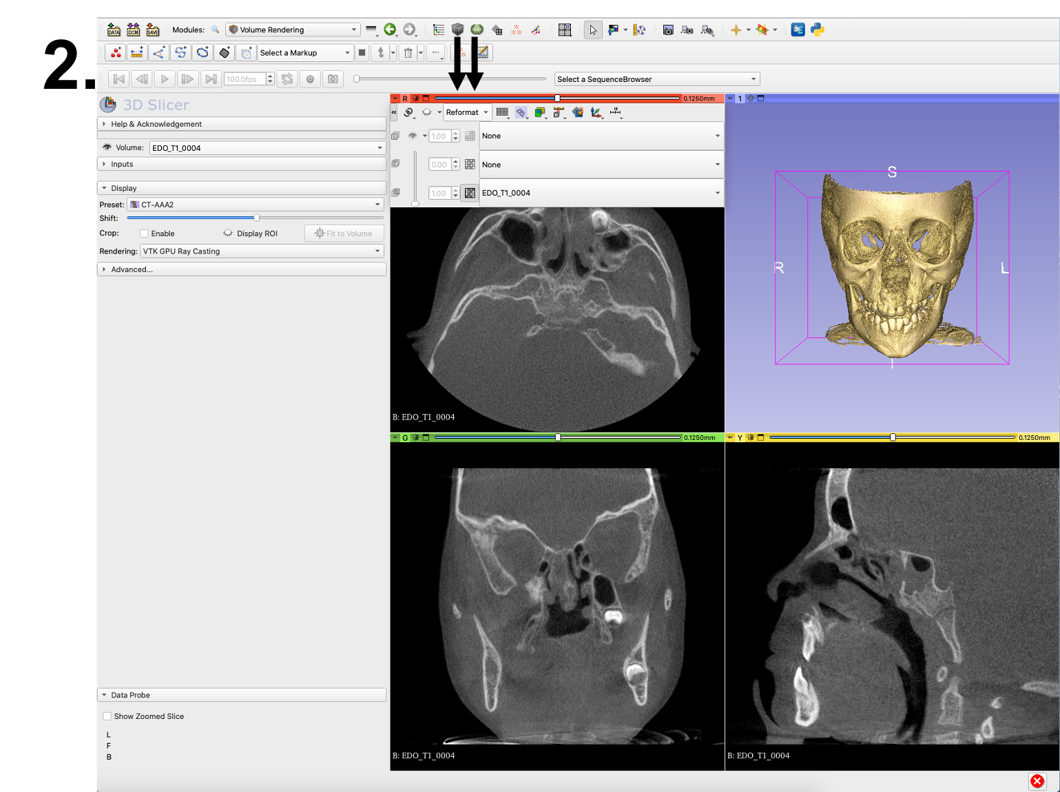 Harden Transform Is Applied For Volume Rendering But Not For Scan · Issue 6664 · Slicer Slicer