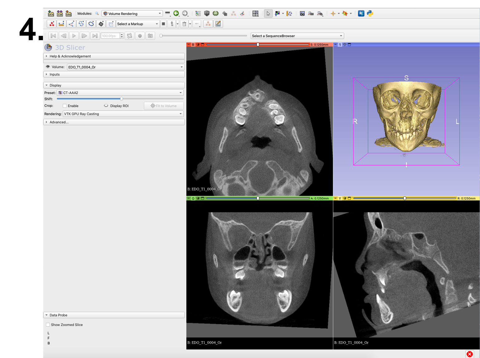 Harden transform is applied for volume rendering but not for scan · Issue #6664 · Slicer/Slicer ...