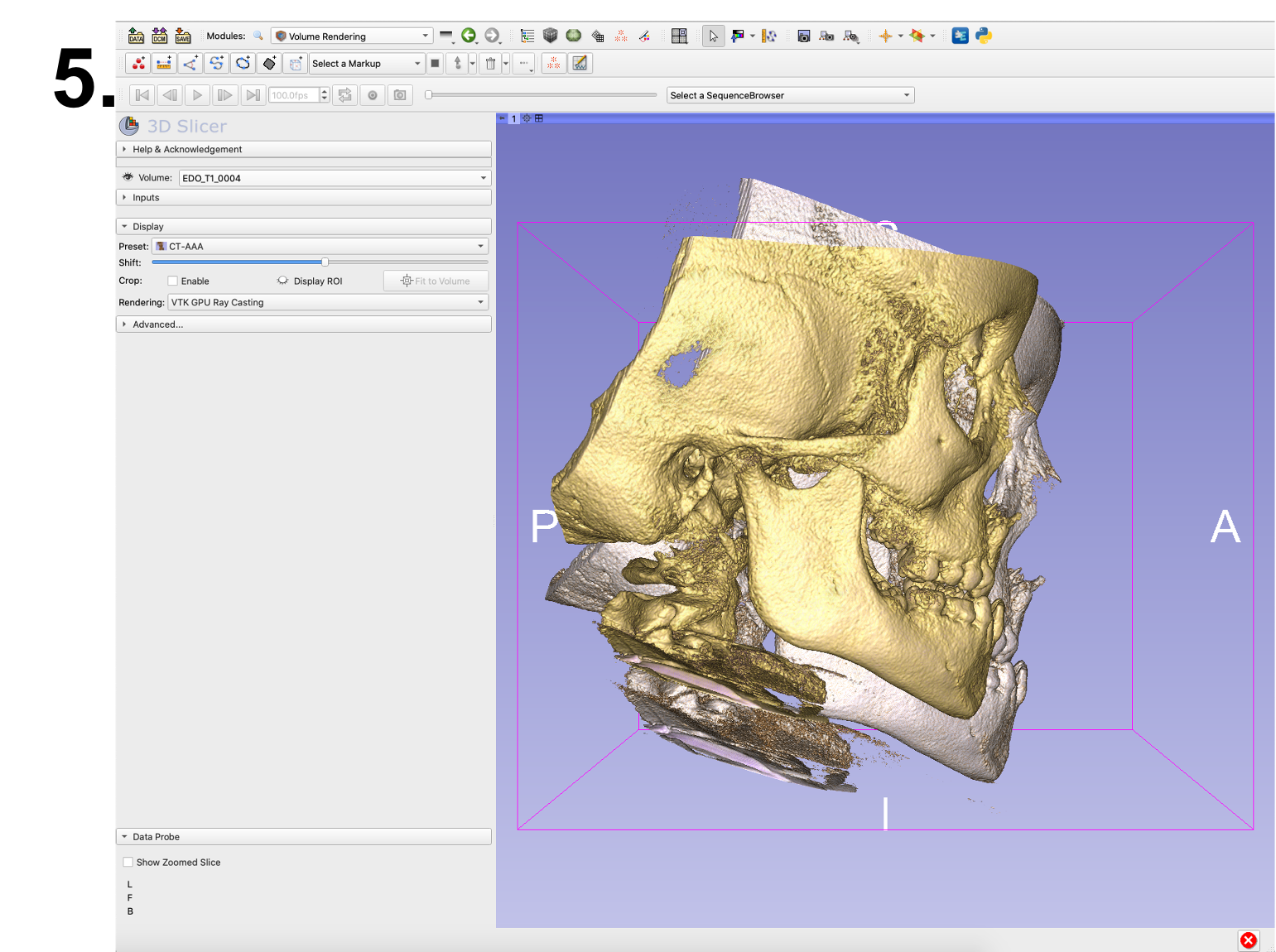 Harden transform is applied for volume rendering but not for scan · Issue #6664 · Slicer/Slicer ...