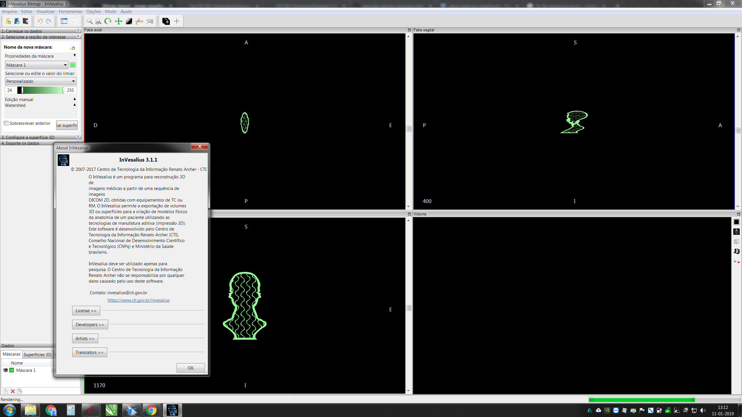 Bitmap import - image squashed · Issue #160 · invesalius/invesalius3 ...