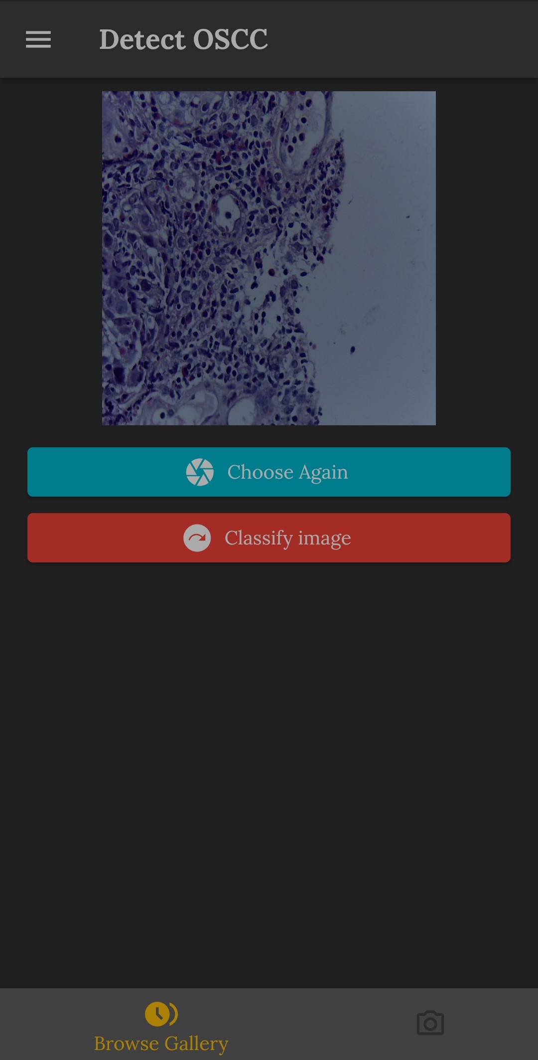 GitHub - Neloy-Barman/OSCC-Detector-App: This is a simple deployment of our undergrad thesis ...