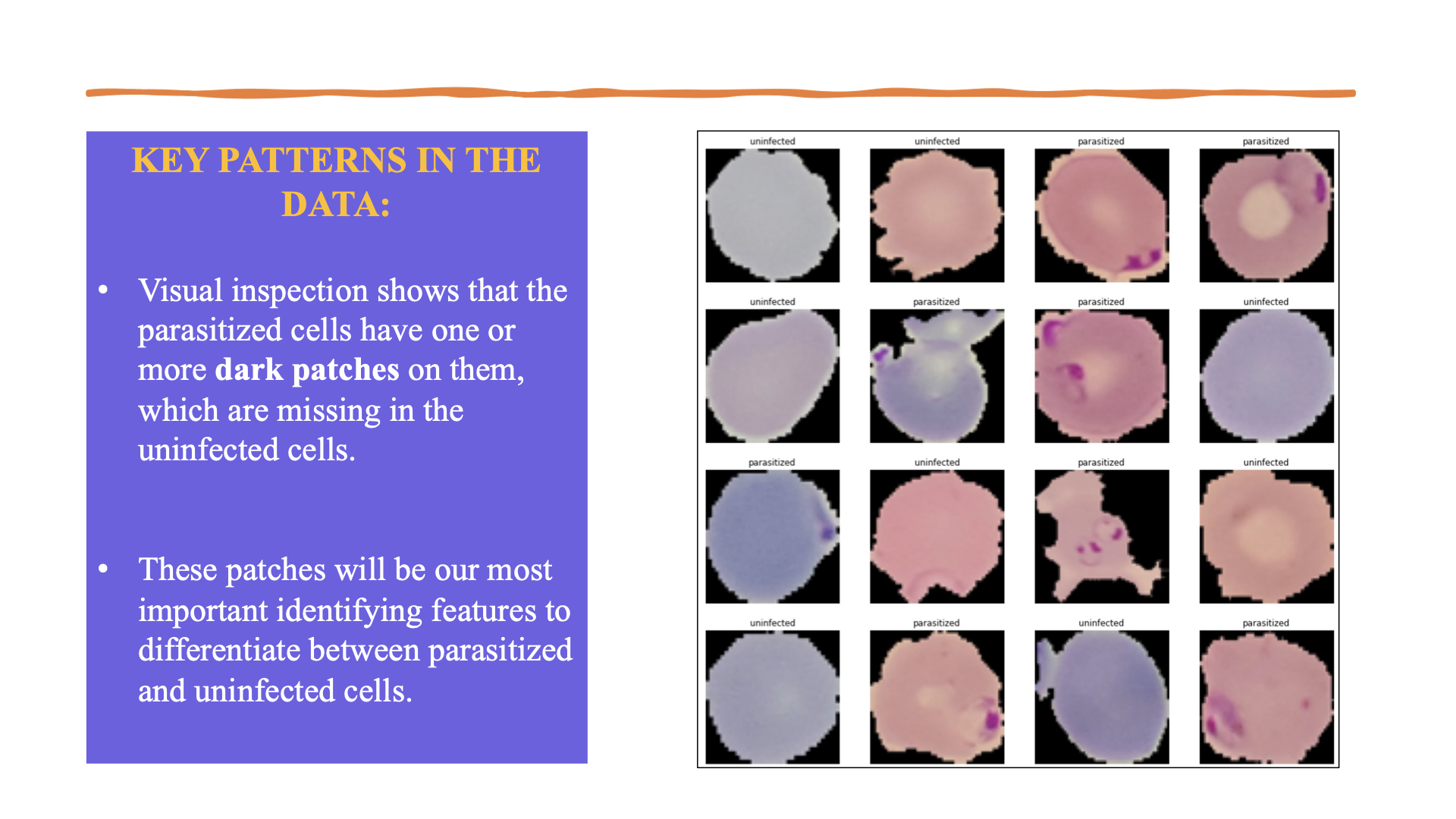 GitHub - Aparajita-Sengupta/Malaria-Detection-Using-Convolutional-Neural-Network: Config files ...