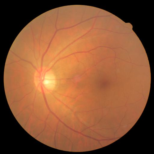 GitHub - Nithish-2002/Predection-of-ocular-disease-using-fundus-images-using-CNN: Deep learning ...