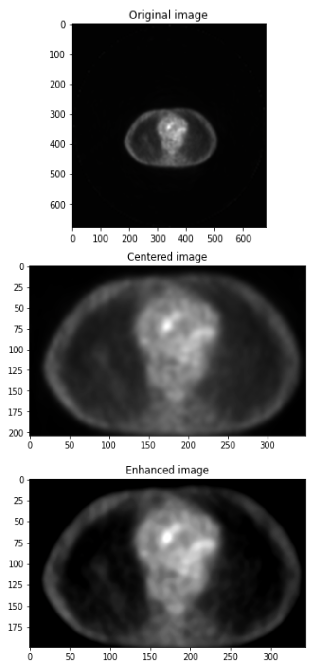 GitHub - Eri0898/Preprocessing-of-whole-lung-3D-PET-scans