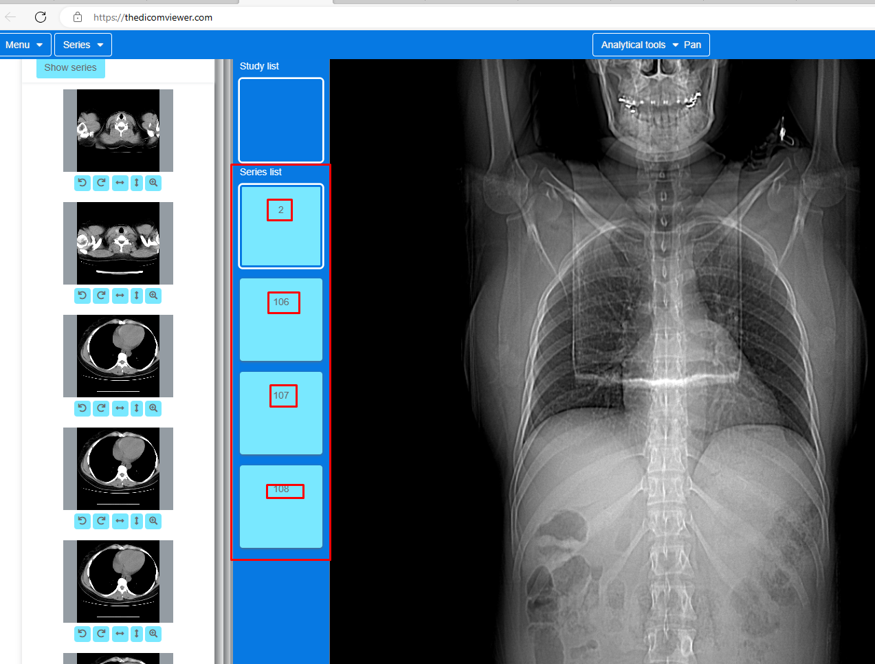 [Feature Request] How group series? · Issue #884 · cornerstonejs/cornerstone3D · GitHub