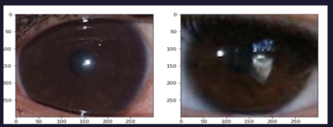 Github Amitkumar7138irisdetectionandrecognition Detection And Recognition Of Human Iris