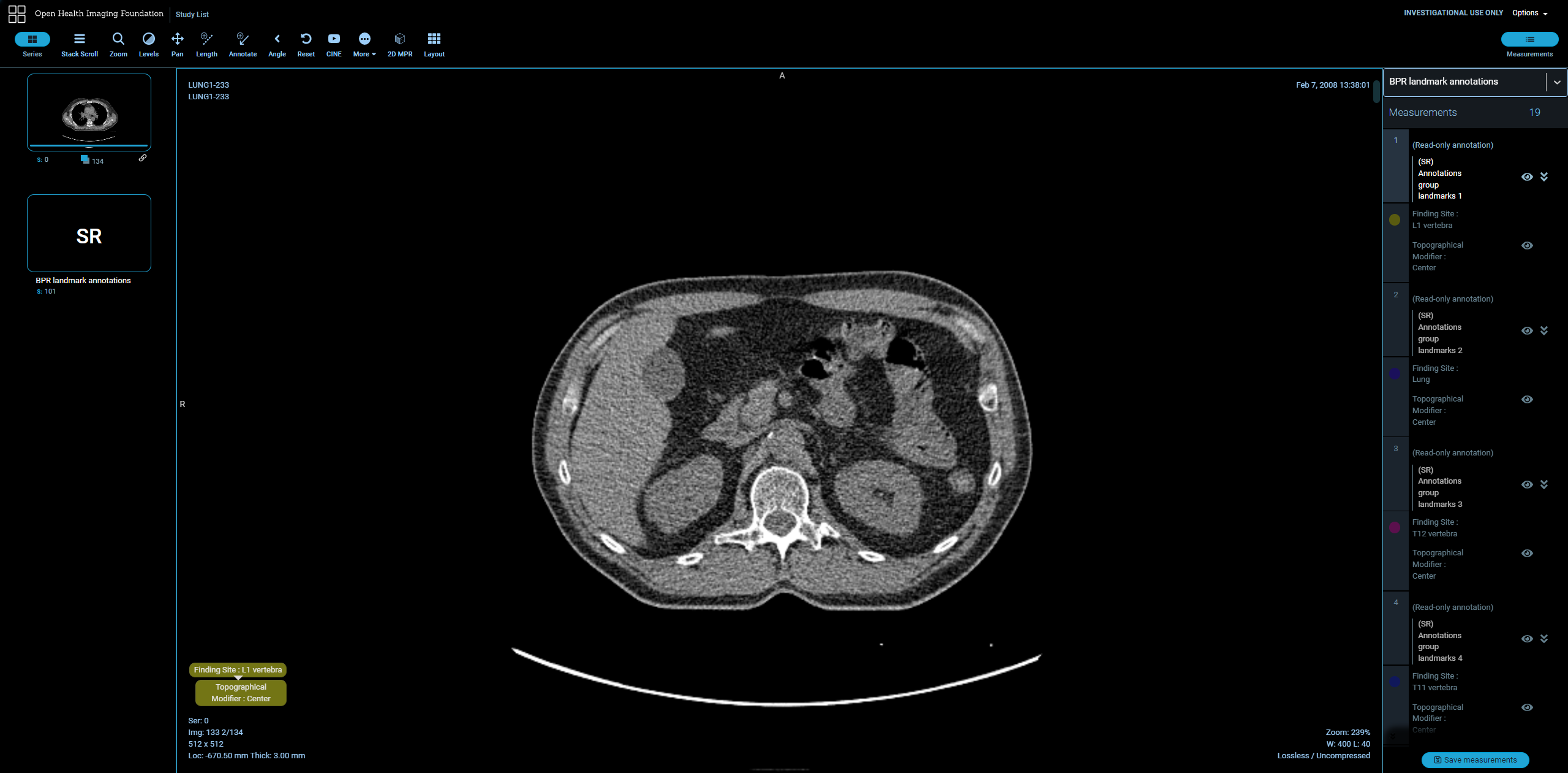 Two-server issue: Instance-level qualitative annotation not correctly handled with inclusion of ...