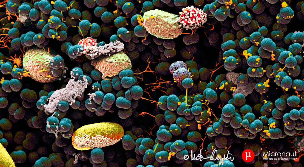 GitHub - GILEV0/belly-button-challenge: Module 14 Challenge