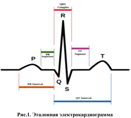 GitHub - Alexds29/ecg_classification