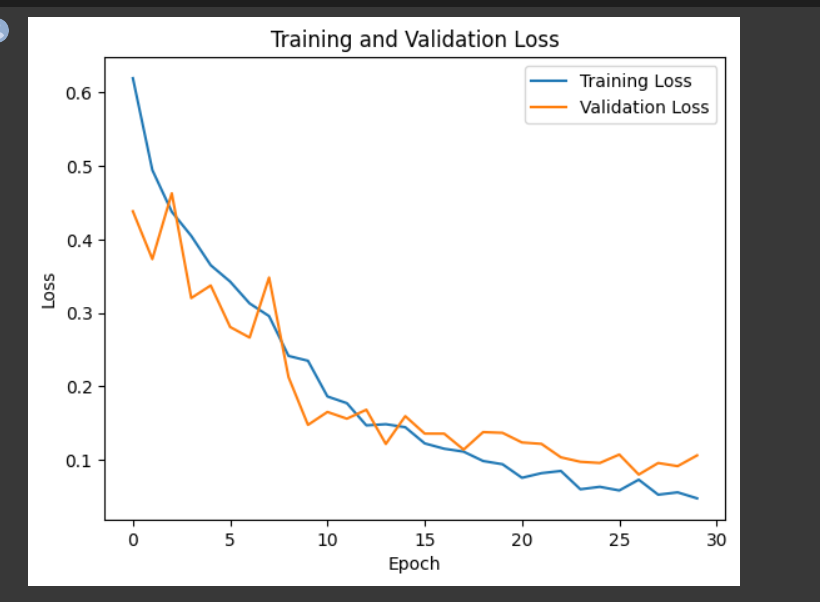 GitHub - Vinay0700/Brain_tumor_Detection