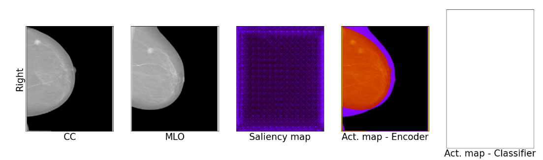 Code to visualize the saliency map · Issue #1 · ispamm/PHBreast · GitHub