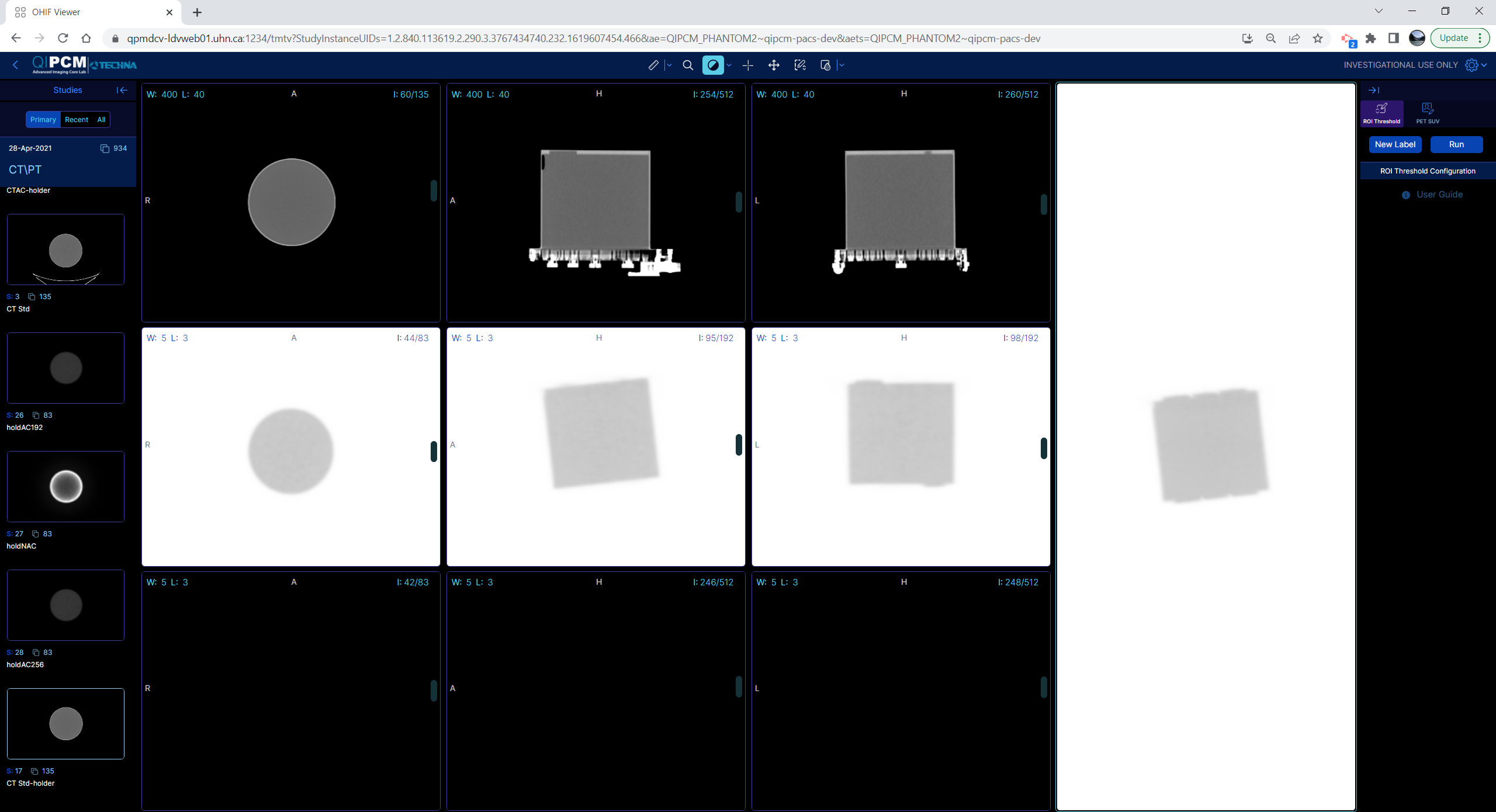TMTV hanging protocol doesn't ensure that PET and CT have the same Frame of Reference · Issue ...