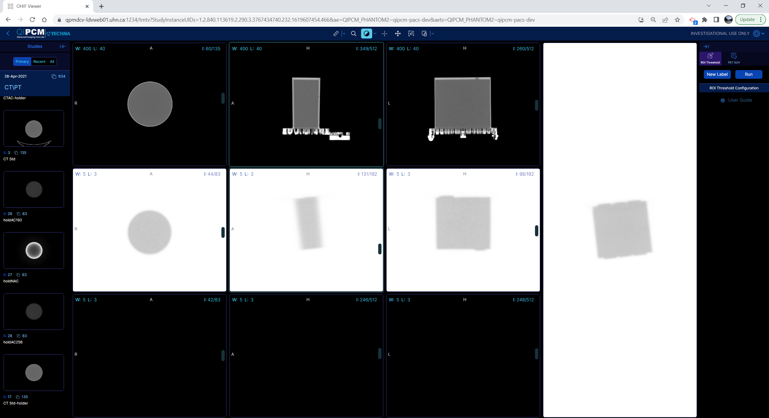 TMTV hanging protocol doesn't ensure that PET and CT have the same ...