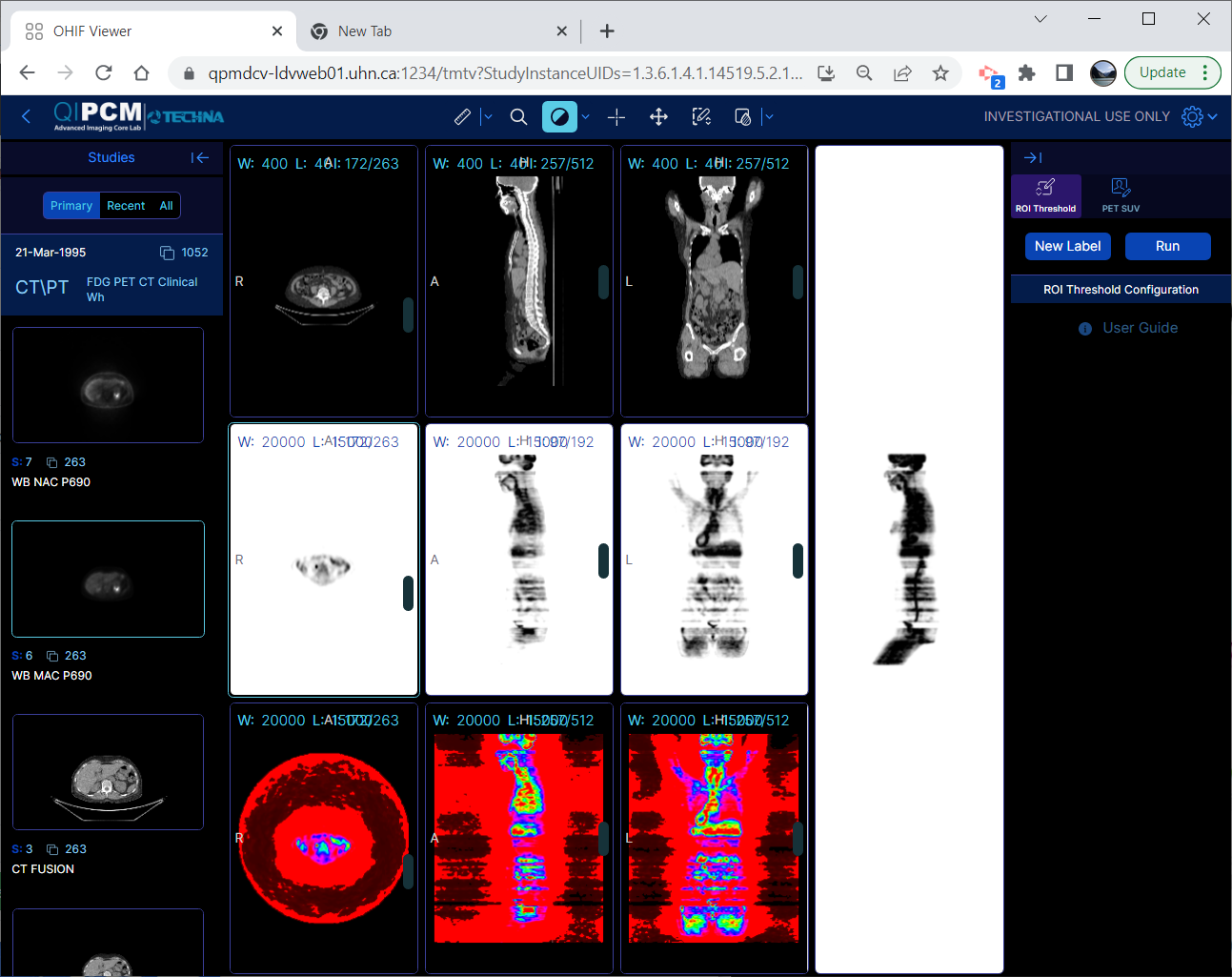 TMTV mode always uses an SUV based window and Level of WW 5 WL 3 even if SUV can't be calculated ...