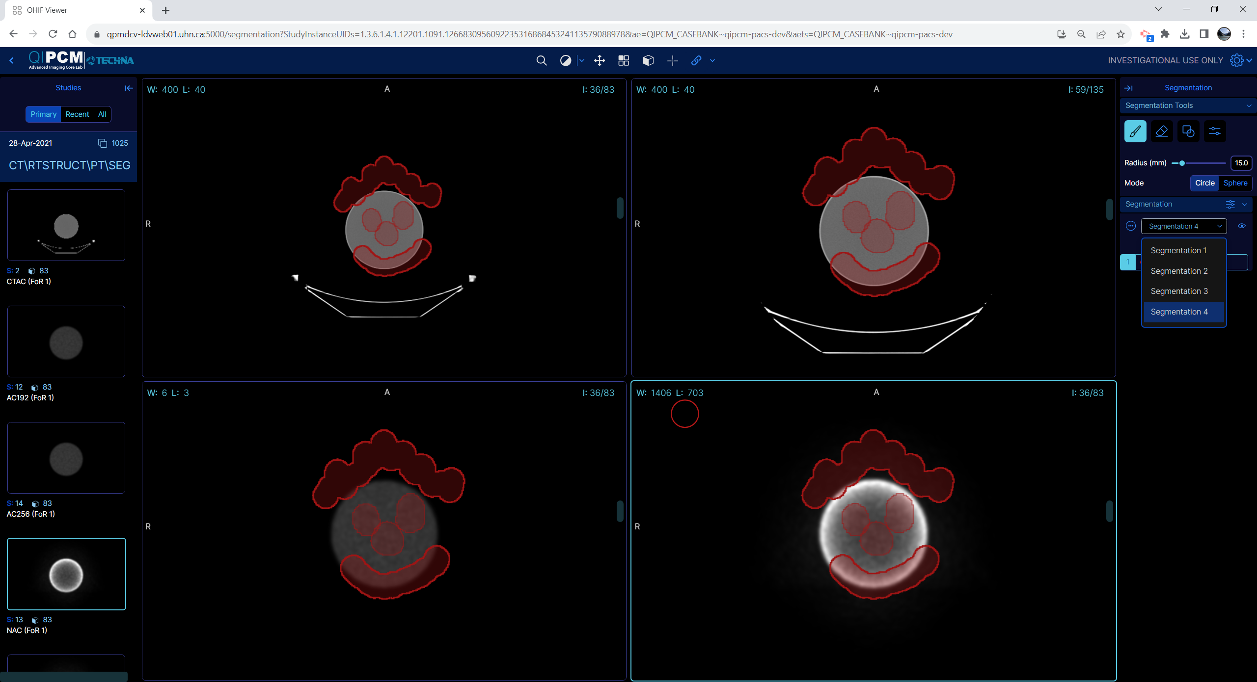 [Feature Request] When creating a new segmentation in [Segmentation Mode] there is no way to ...