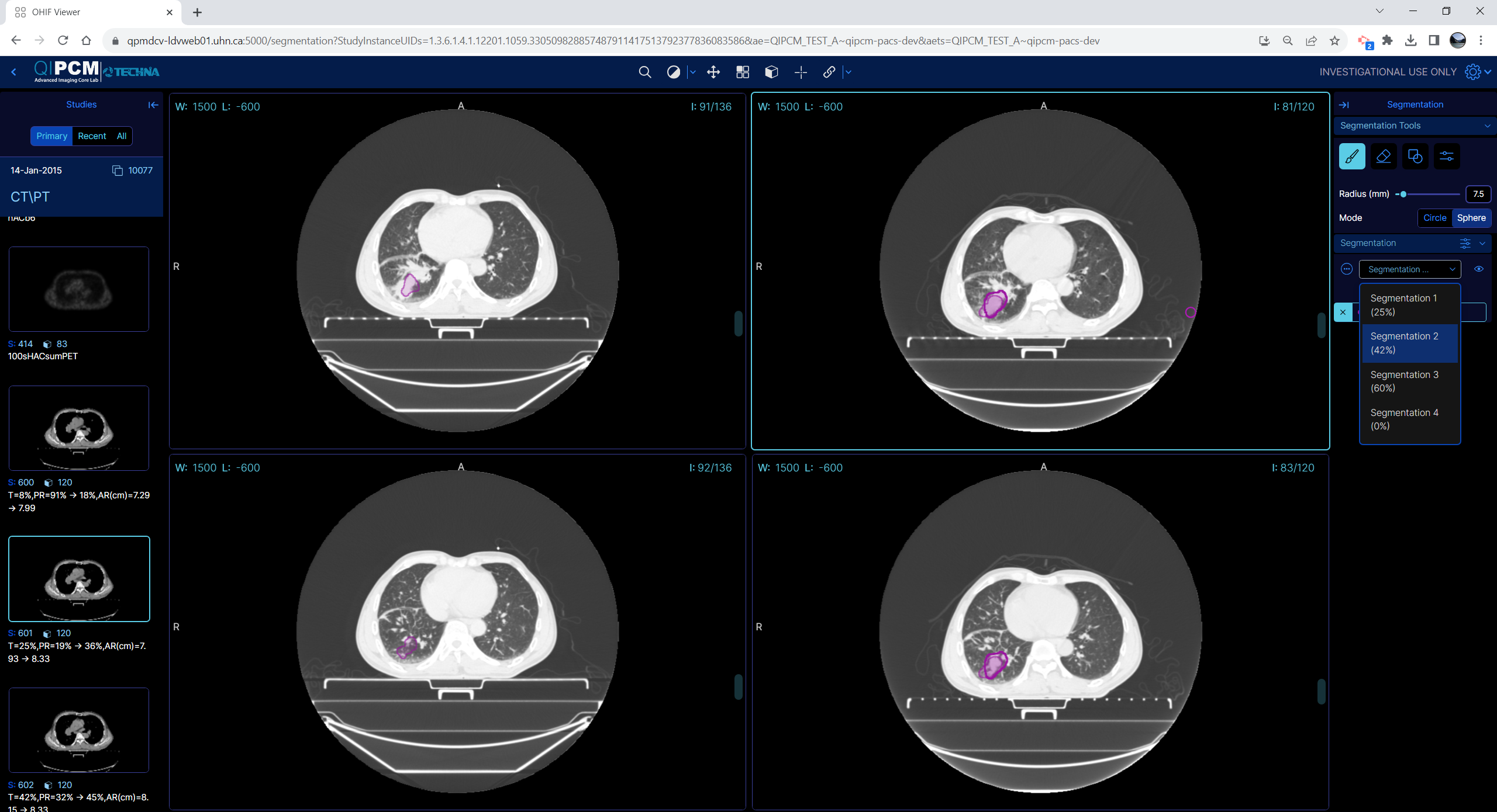 [Feature Request] When creating a new segmentation in [Segmentation ...