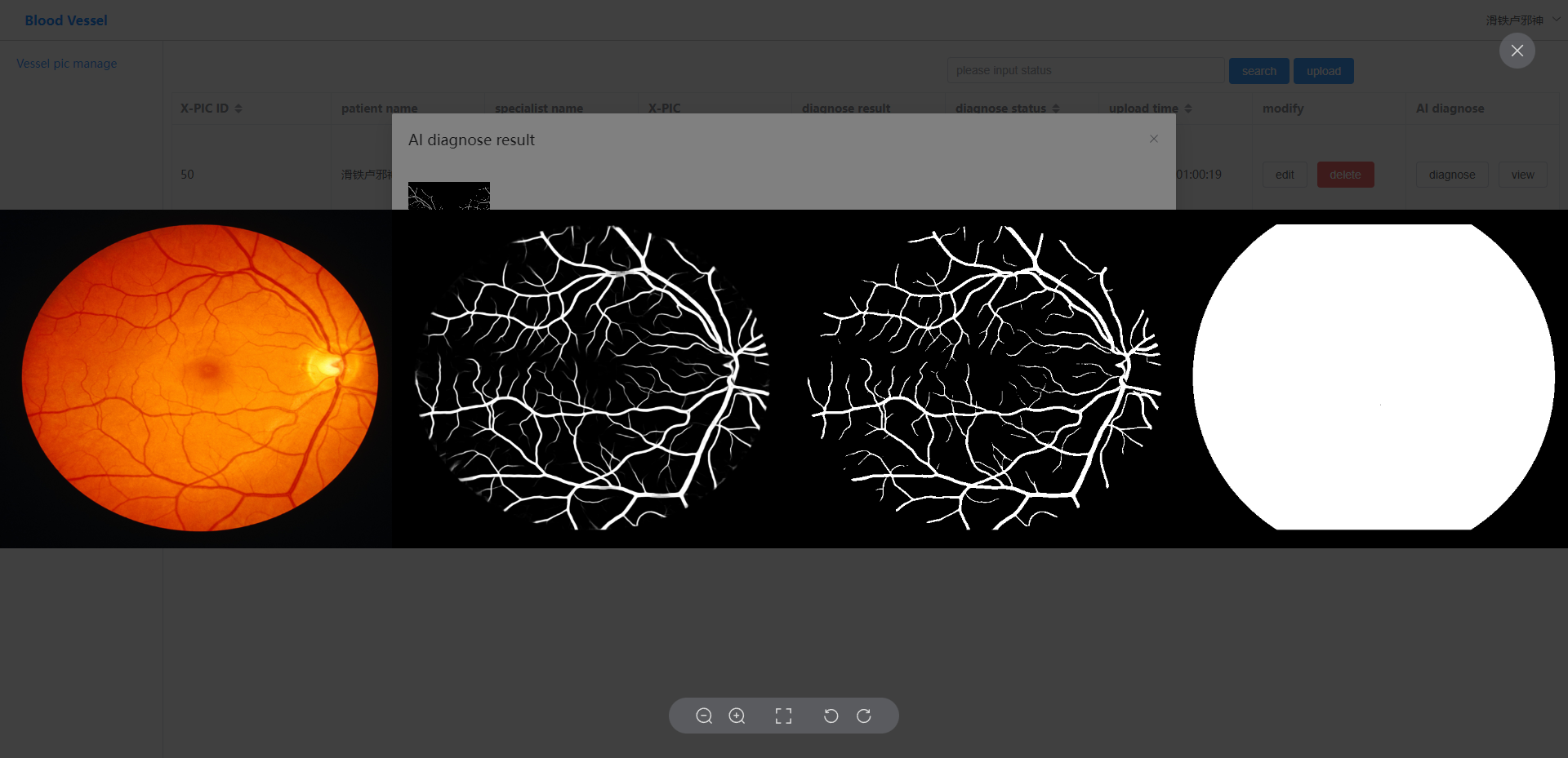 GitHub - wentacc/Blood-Vessel-Diagnose-Cloud-Platform: Blood Vessel ...
