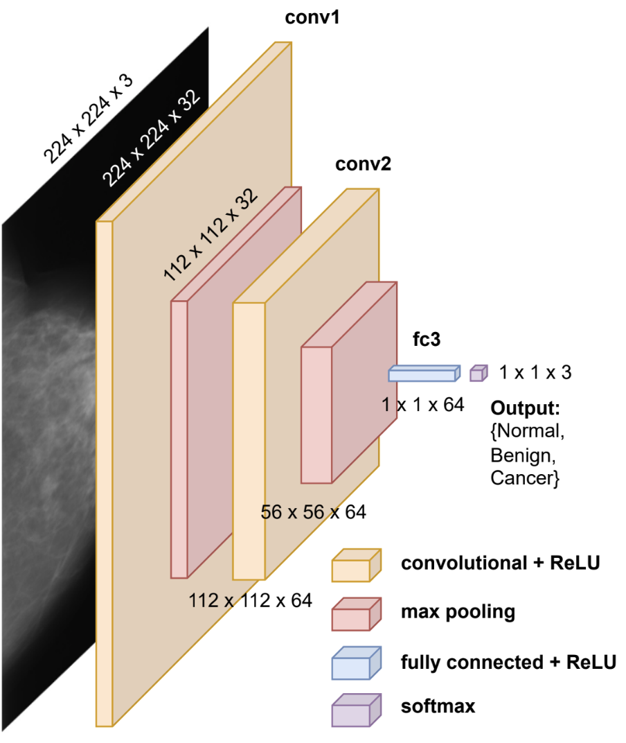GitHub - ambrim/breast_cancer_detection: COS429 Computer Vision Final Project classifying ...