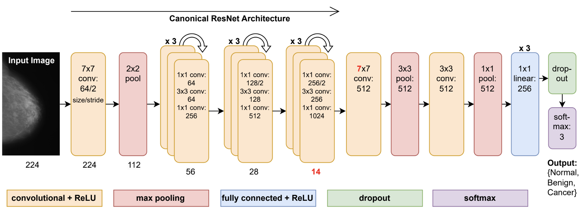 GitHub - ambrim/breast_cancer_detection: COS429 Computer Vision Final Project classifying ...