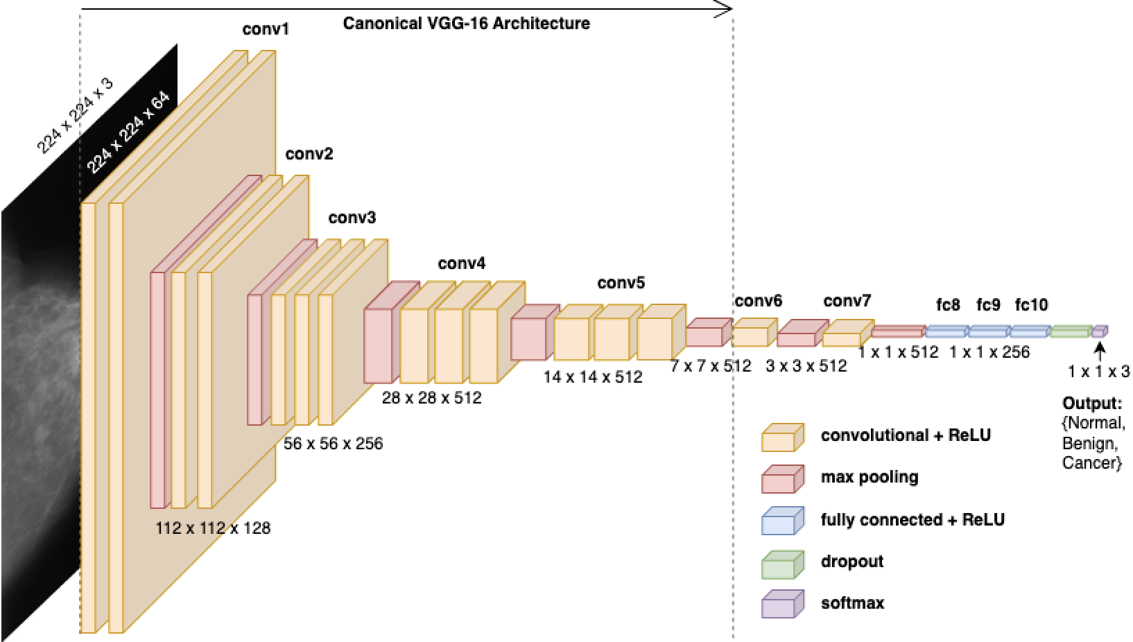 GitHub - ambrim/breast_cancer_detection: COS429 Computer Vision Final Project classifying ...