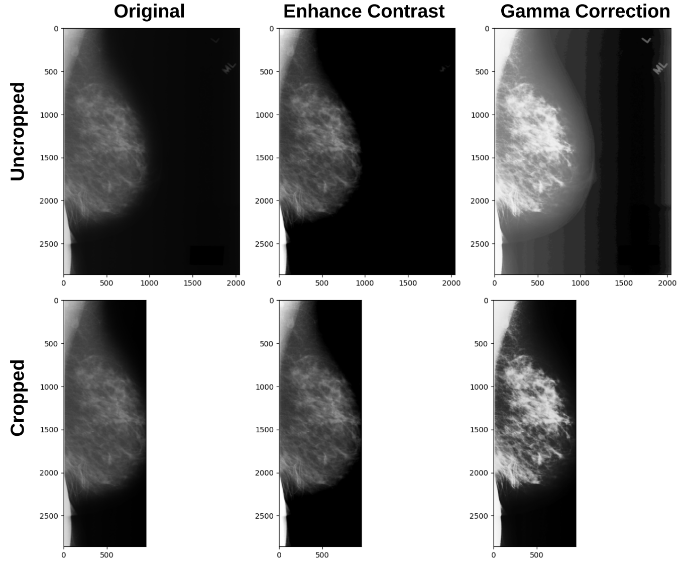 GitHub - ambrim/breast_cancer_detection: COS429 Computer Vision Final Project classifying ...