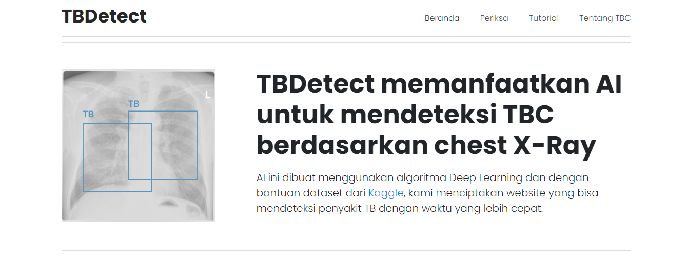 GitHub - brnsbrn/TBDetect: Application that can define someone with tuberculosis using chest x-ray
